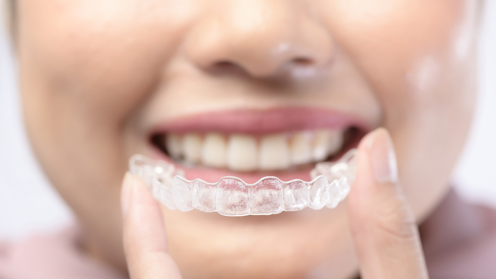 Does Insurance Cover Invisalign? 6 Important Facts